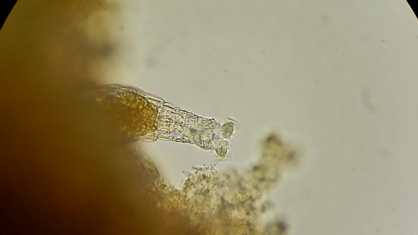 Live Microscopic Animal Rotifer Feeding Under Microscope 400x Stock ...