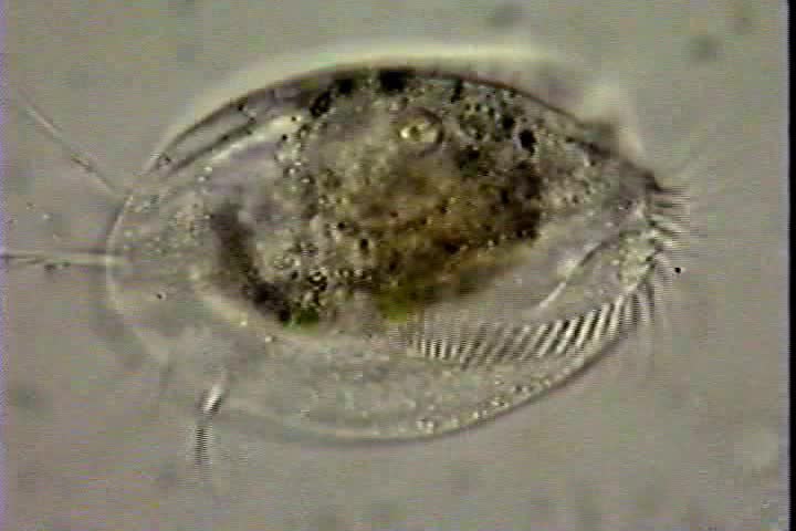 Euplotes Under Microscope